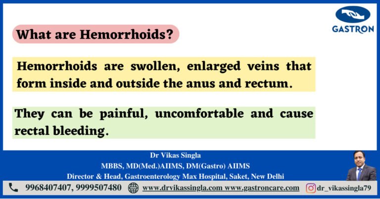 Hemorrhoids: Types, Symptoms and Preventions - Gastron