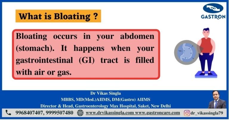Bloating - Causes, Symptoms and Treatment - Gastron